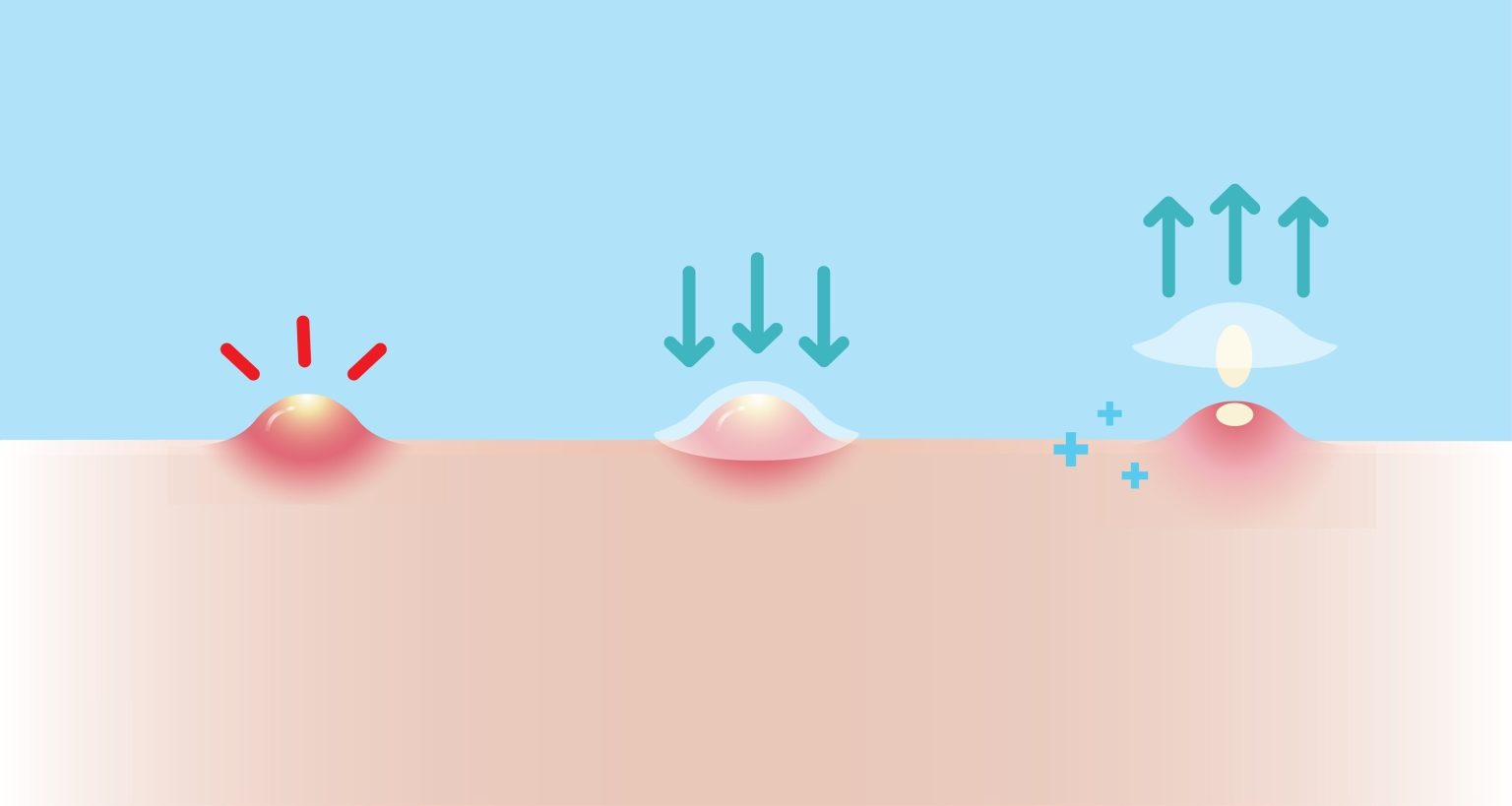 How Do Pimple Patches Work Skincare Products Scanner App Onskin