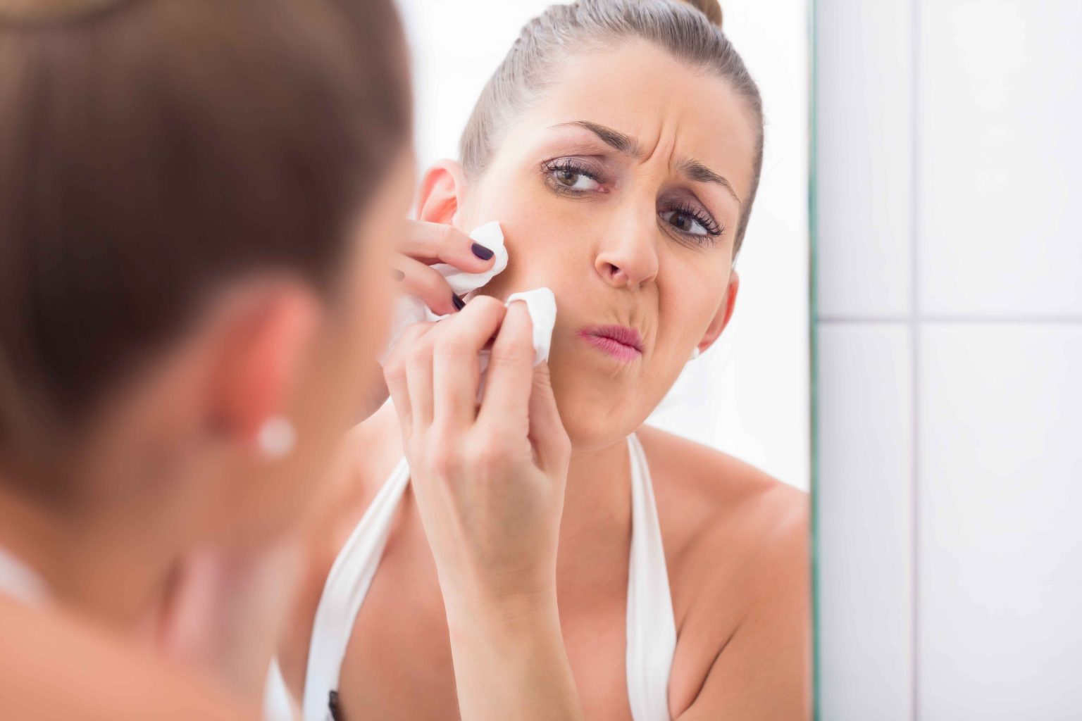 Should I Pop My Pimple? These 3 Key Points Can Help You Decide
