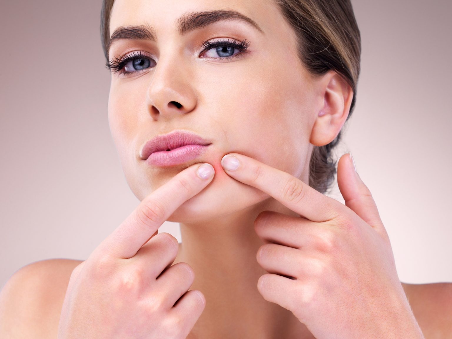 What Makes Acne Worse: 8 Habits You Should Stop Now