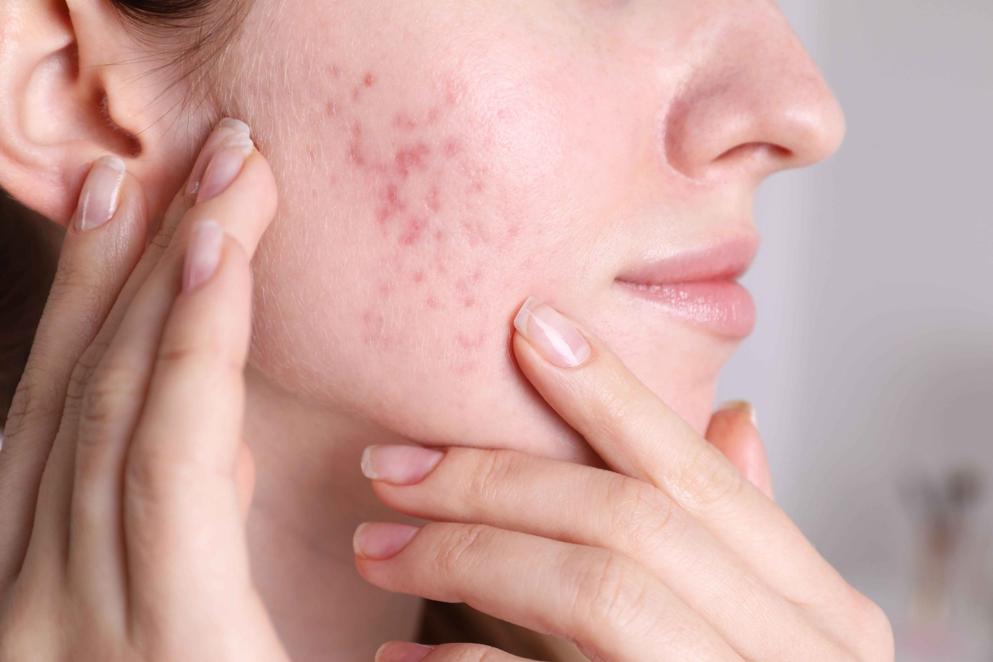 Skin Acids Explained: Top 7 Every Skincare Lover Should Know
